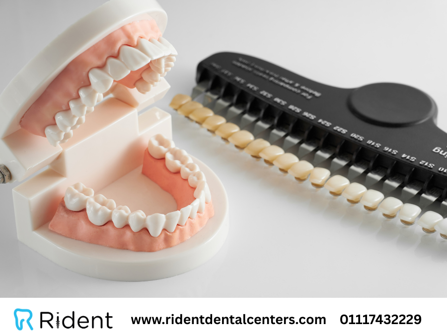 الفرق بين الزراعة العادية والفورية للأسنان | Rident Dental Centers